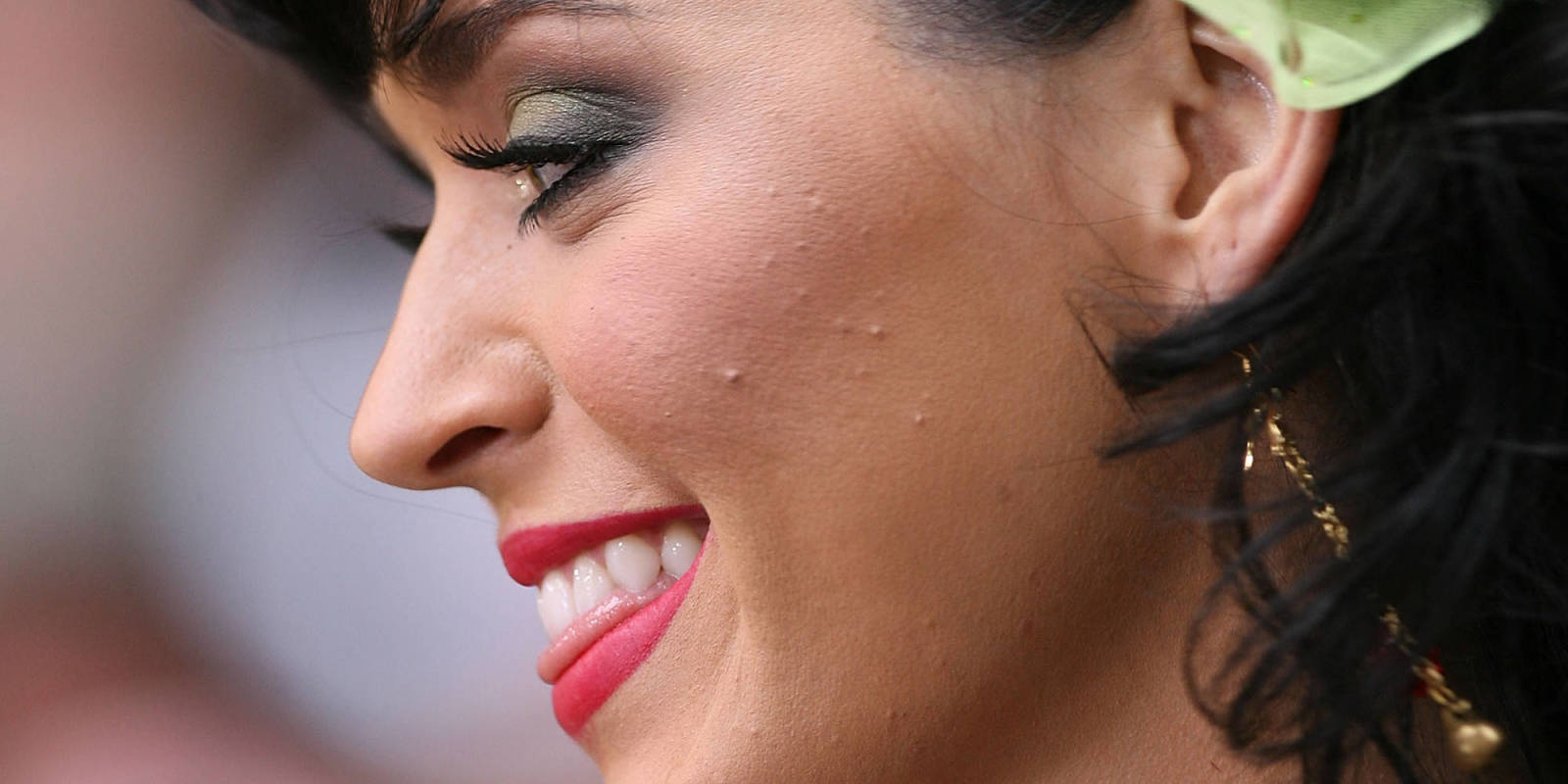 Celebrities With Acne And How They Deal With It Celebrities With Acne And How They Deal With It