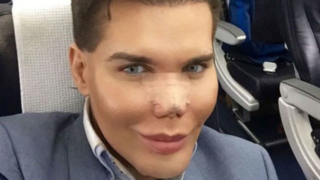 Real Life Ken Before And After