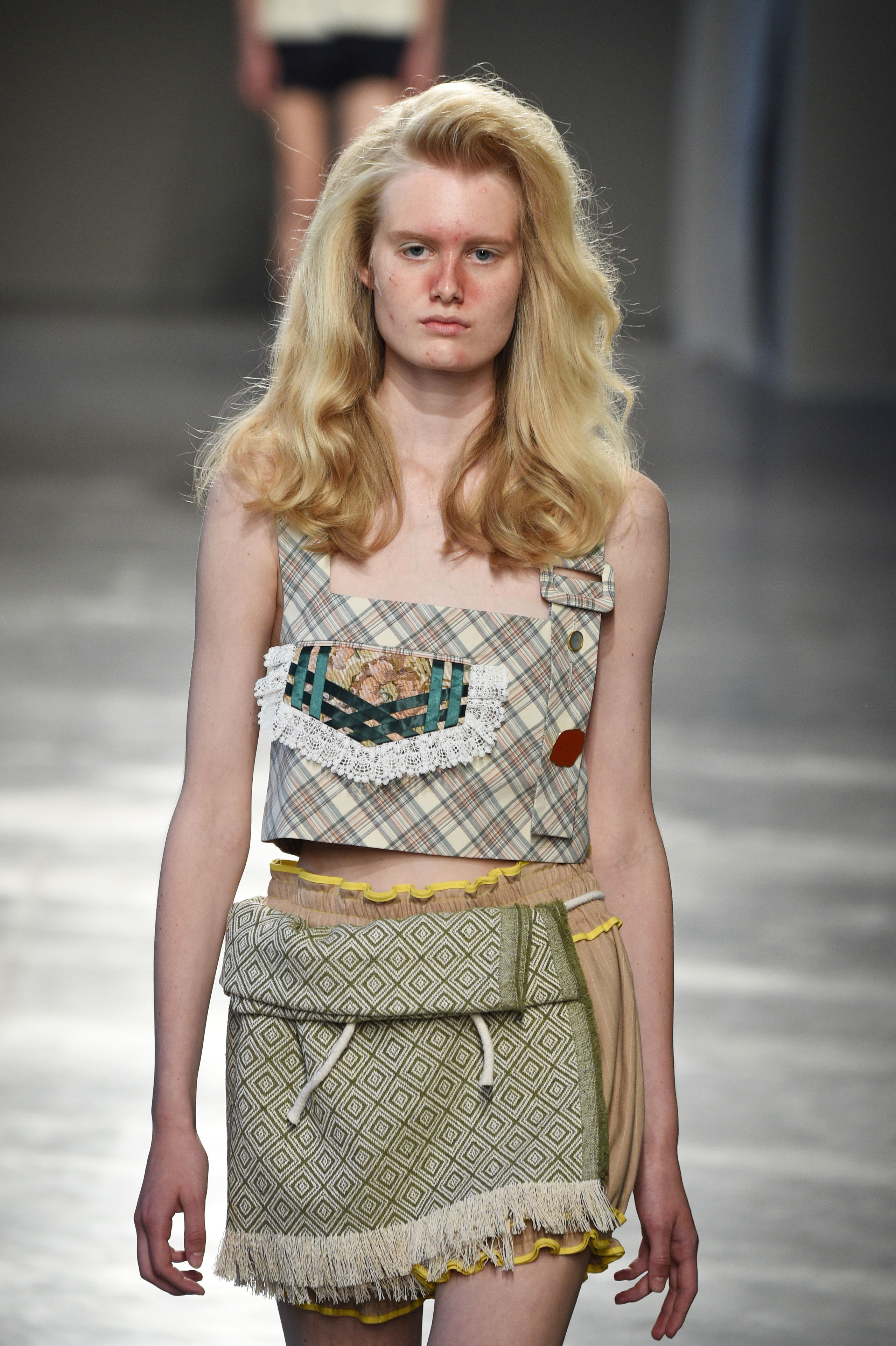 Models With Acne Carlynn Patten | 🌟 Model Call: Seeking Acne And