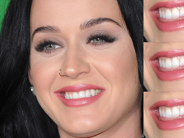 Katy Perry Teeth Katy Perry Laughs Off Quinoa In Her Teeth | Real 95.9